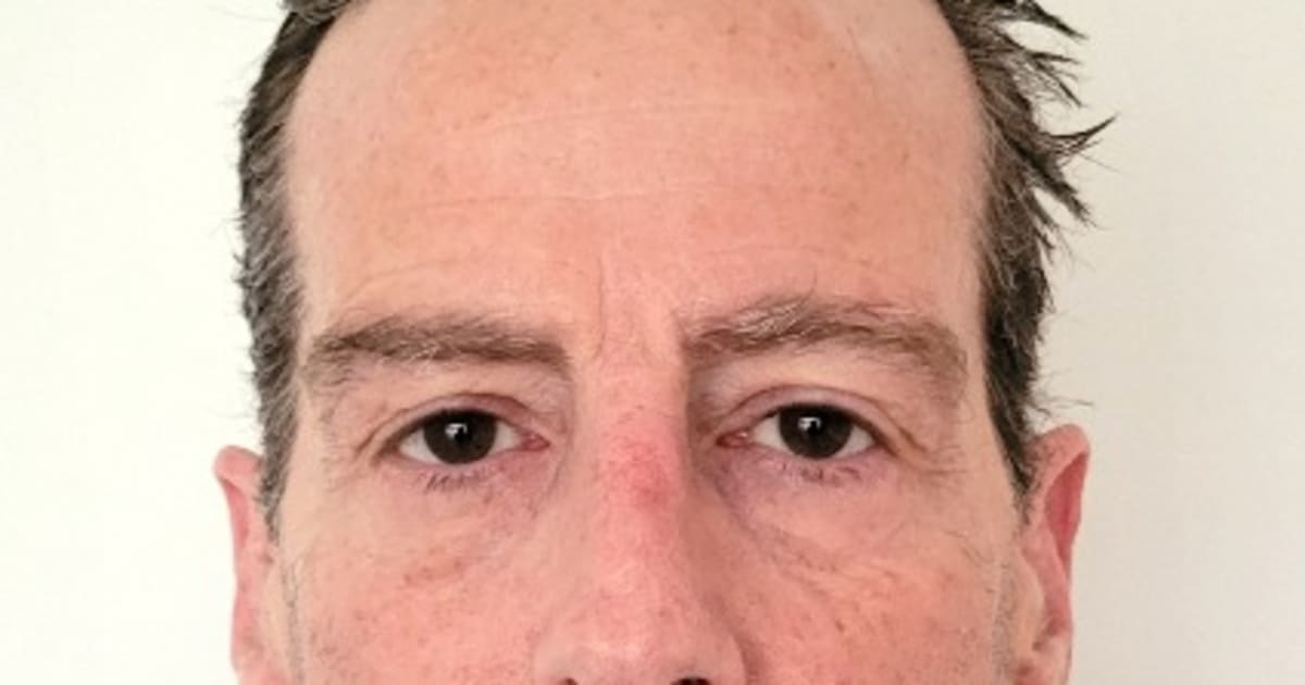 Kenny ATKINSON