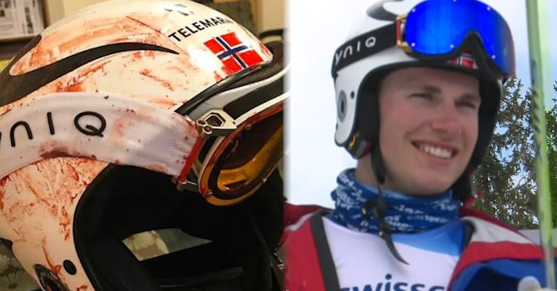 Telemark champ shows why you always wear a helmet